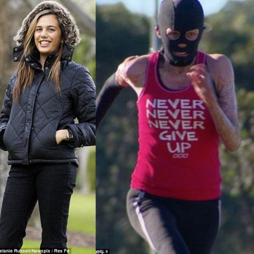 GirlTalkHQ – How Burn Victim & Cover Girl Turia Pitt Changed The Face ...