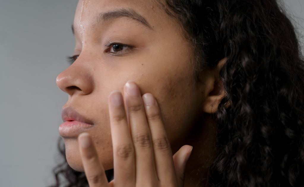 How CBD Cream Can Alleviate Skin Issues Like Eczema - GirlTalkHQ